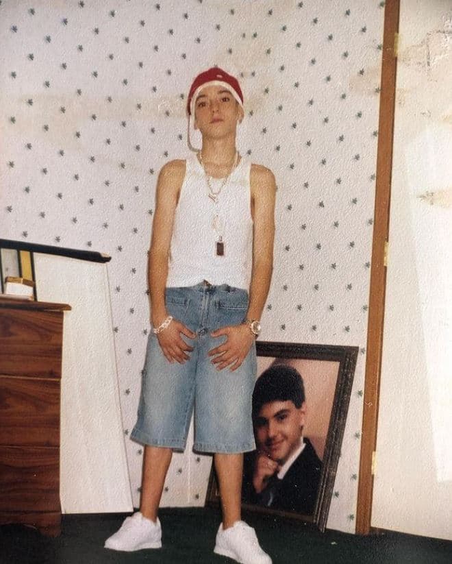 Fotos de antes y después de Pee Wee, integrante de los Kumbia Kings: ya ...
