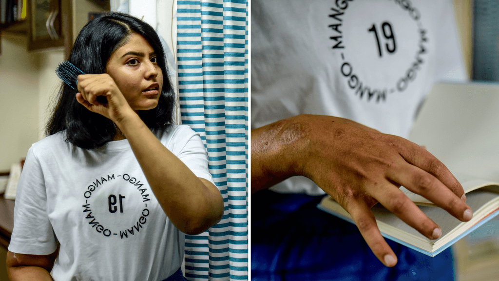 El caso médico de Shreya Siddanagowder, quien recibió un trasplante de ...