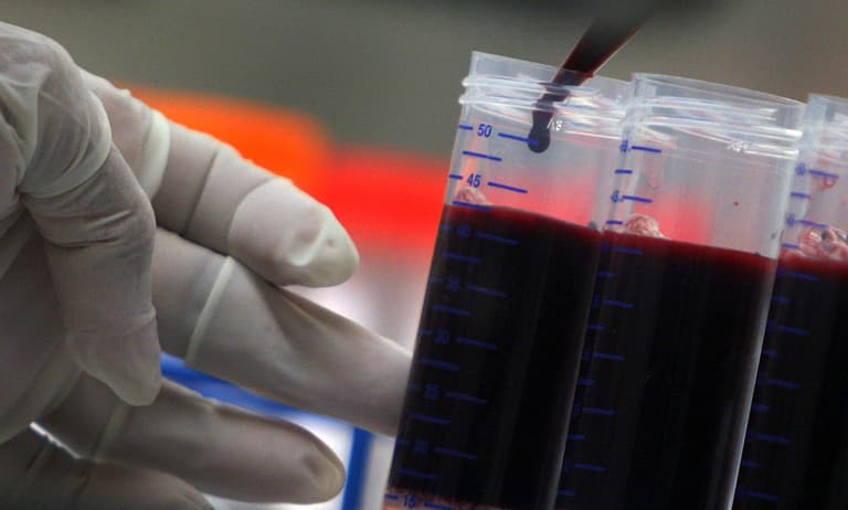 Indetectable = intransmisible: la verdad sobre el contagio del VIH poco ...