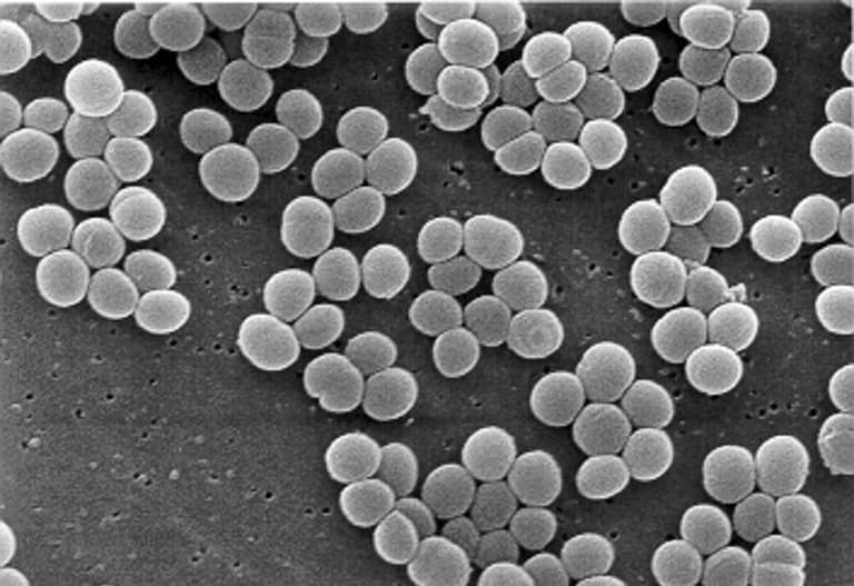 10 impresionantes fotografías de bacterias al microscopio | Explora ...