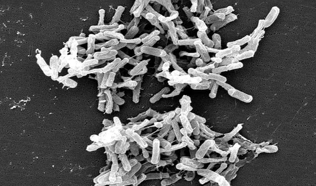 10 impresionantes fotografías de bacterias al microscopio | Explora ...