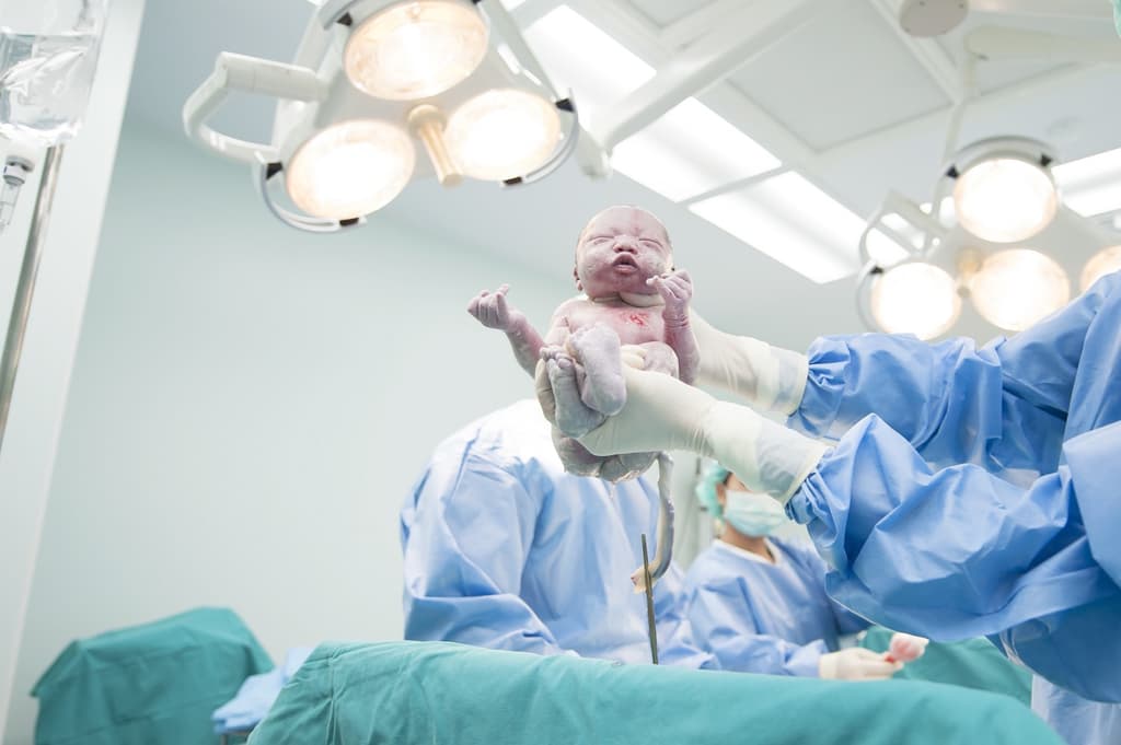 Anestesia epidural vs espinal (raquídea) ¿cuál es la mejor opción para ...