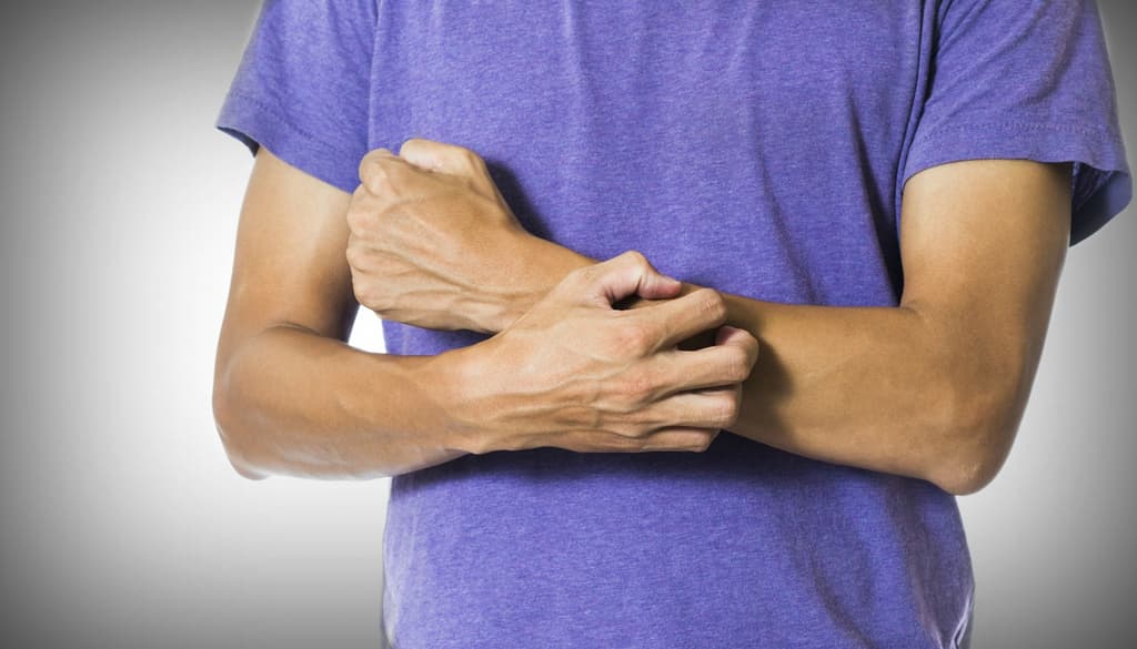 Picazón: ¿qué puede ser? Desde cáncer hasta estrés, conoce las 14 ...