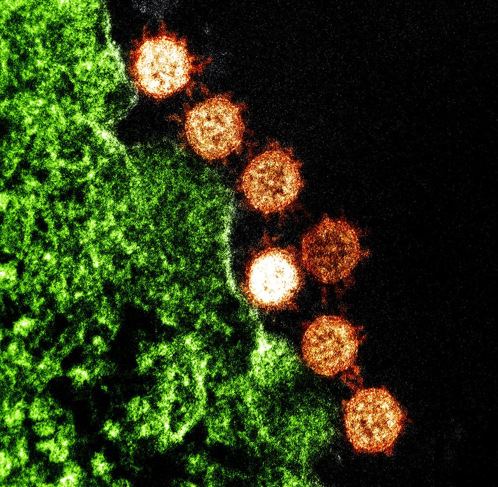 Cómo se ven de cerca los virus más mortales de la historia | Explora ...