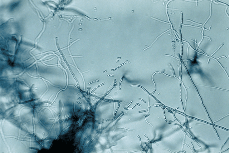 10 impresionantes fotografías de bacterias al microscopio | Explora ...