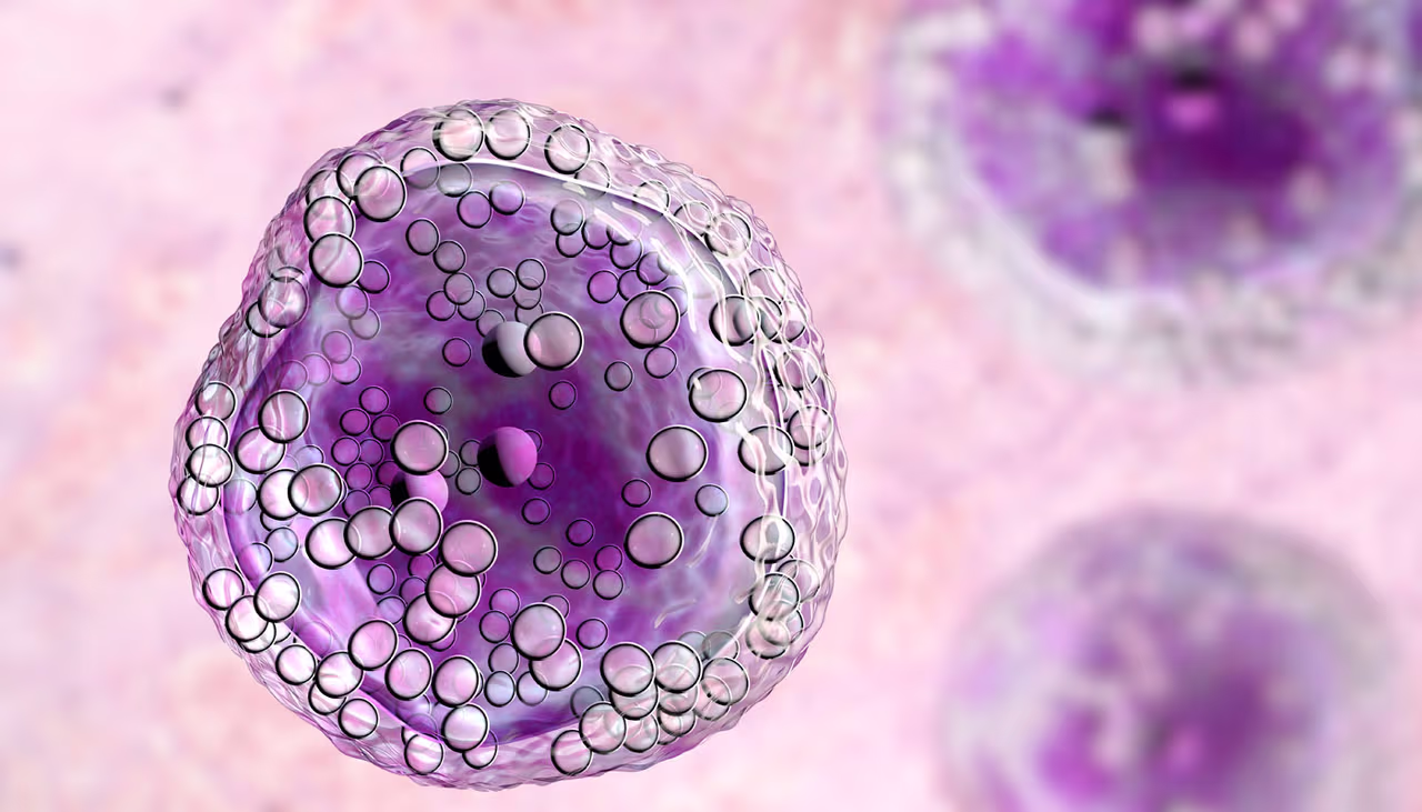La inflamación en el cuello puede ser un síntomas de cáncer en el ...