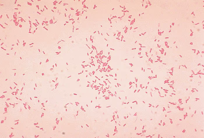 10 impresionantes fotografías de bacterias al microscopio | Explora ...