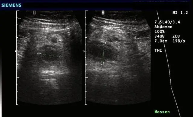 La impresionante historia de Leonid Rogozov, el hombre que se operó a ...