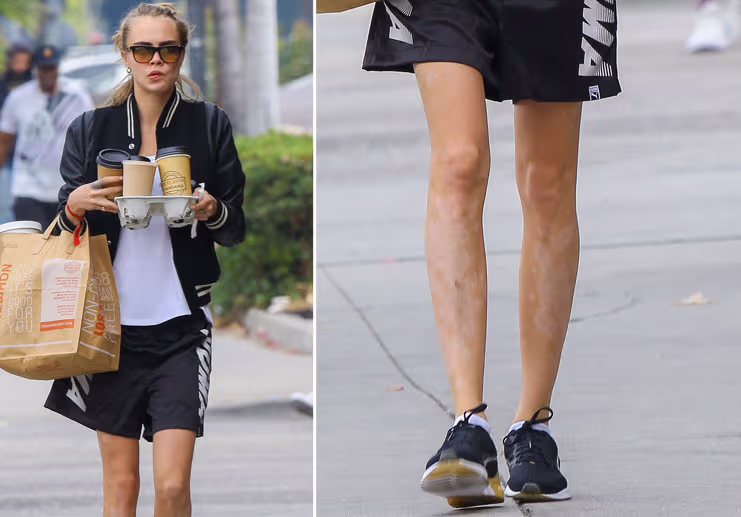 Cara Delevingne luce extremadamente delgada | Univision Famosos | Univision