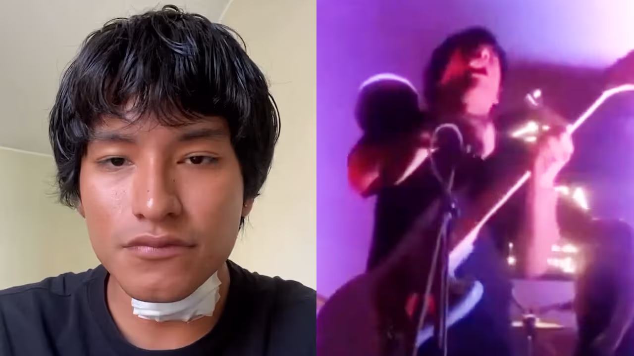 Dramático video: momento en que famoso cantante peruano es ...