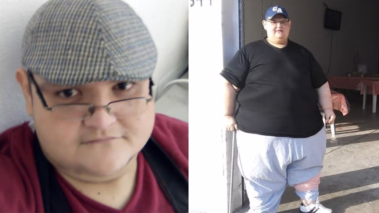 Muere Juan Pedro Franco, mexicano que fue el hombre más obeso del mundo ...