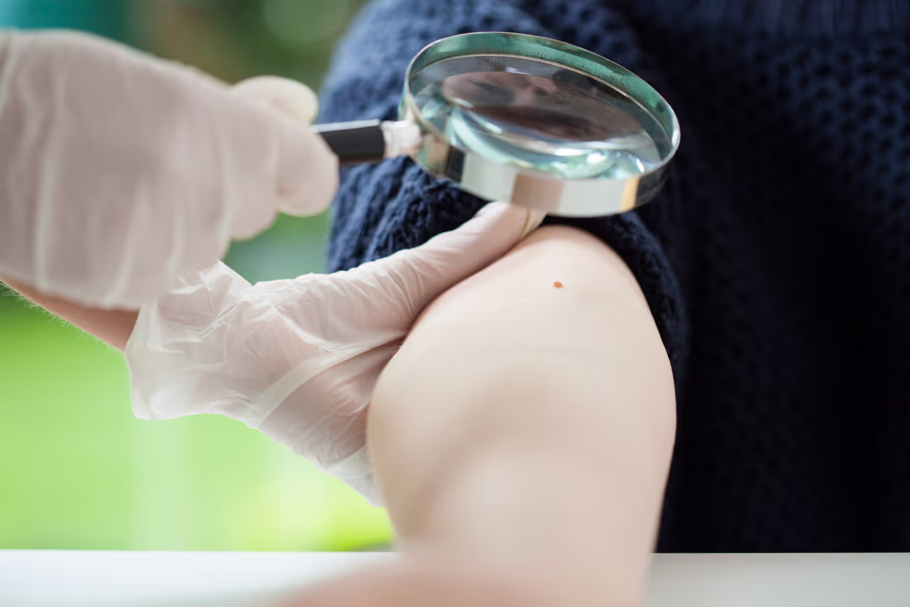 El doctor Aaron Mangold explica cómo detectar y prevenir el cáncer de ...