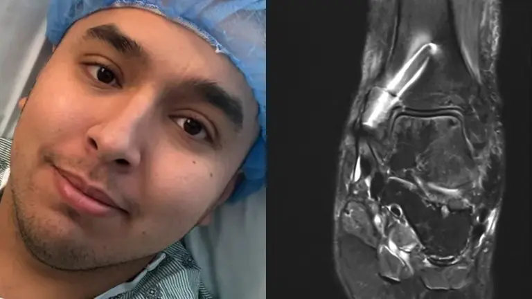 Hispano desarrolla enfermedad rara tras accidente laboral en Texas que ...