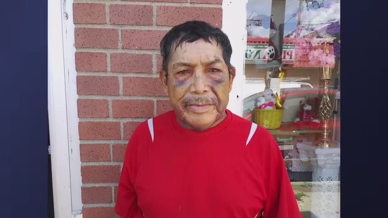 “Me pegaron duro en la cara”: roban y agreden a paletero de 80 años en ...