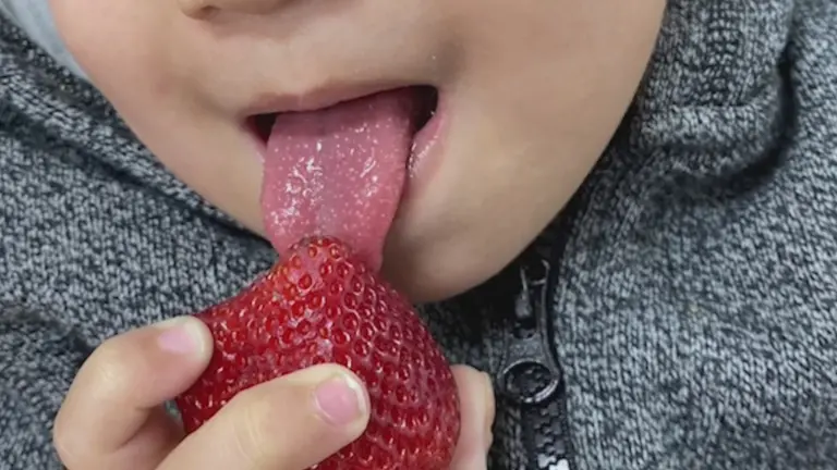 Fiebre escarlatina: qué es, cuáles son los síntomas y por qué preocupa ...