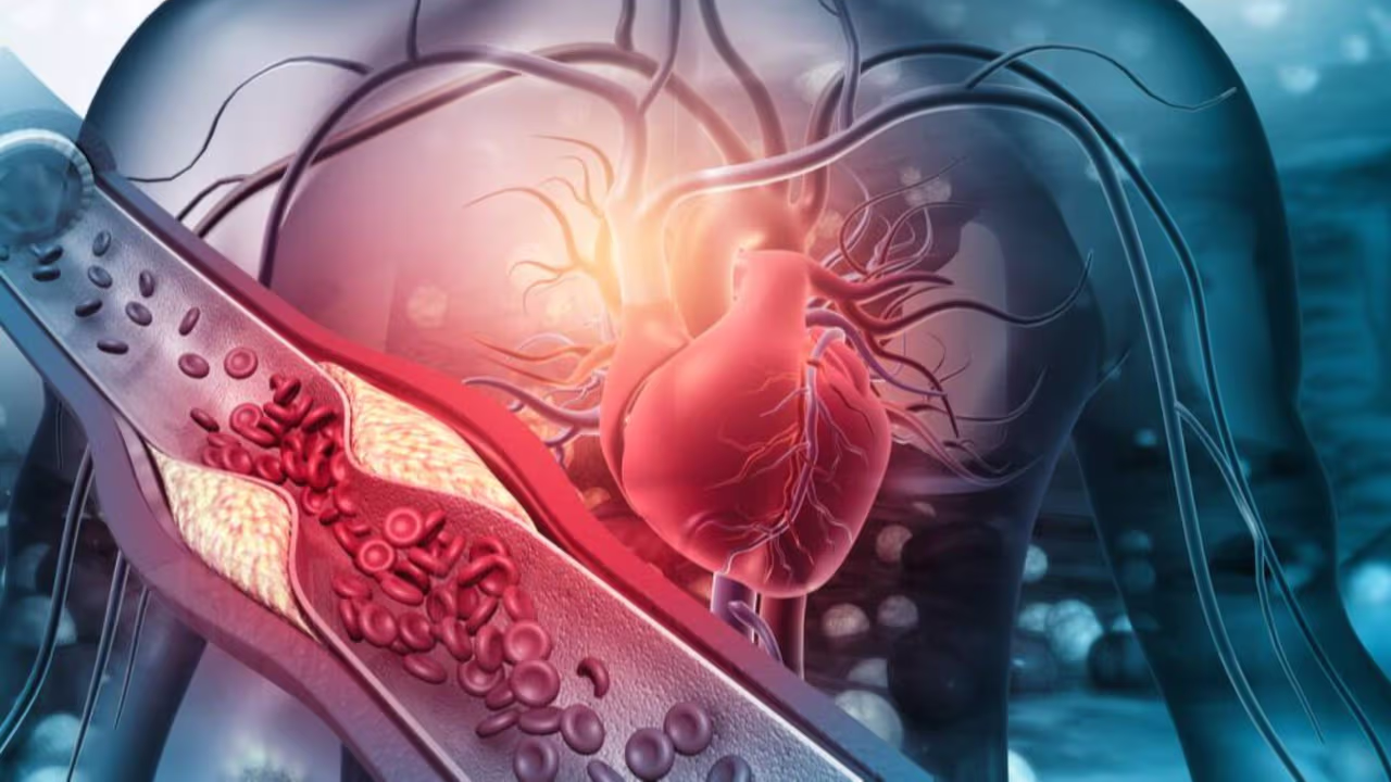Factores de riesgo de enfermedad cardiovascular: 90% de las mujeres ...