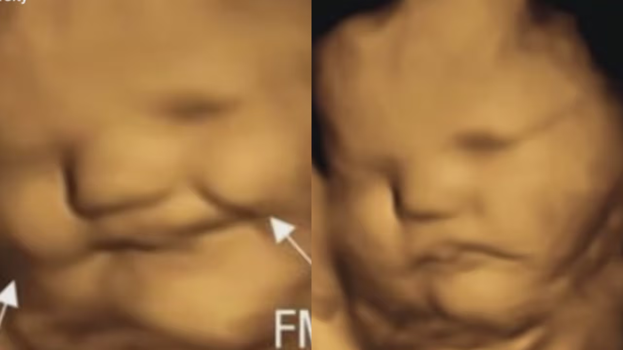 Fetos hacen cara de gusto cuando sus madres comen zanahoria y de ...